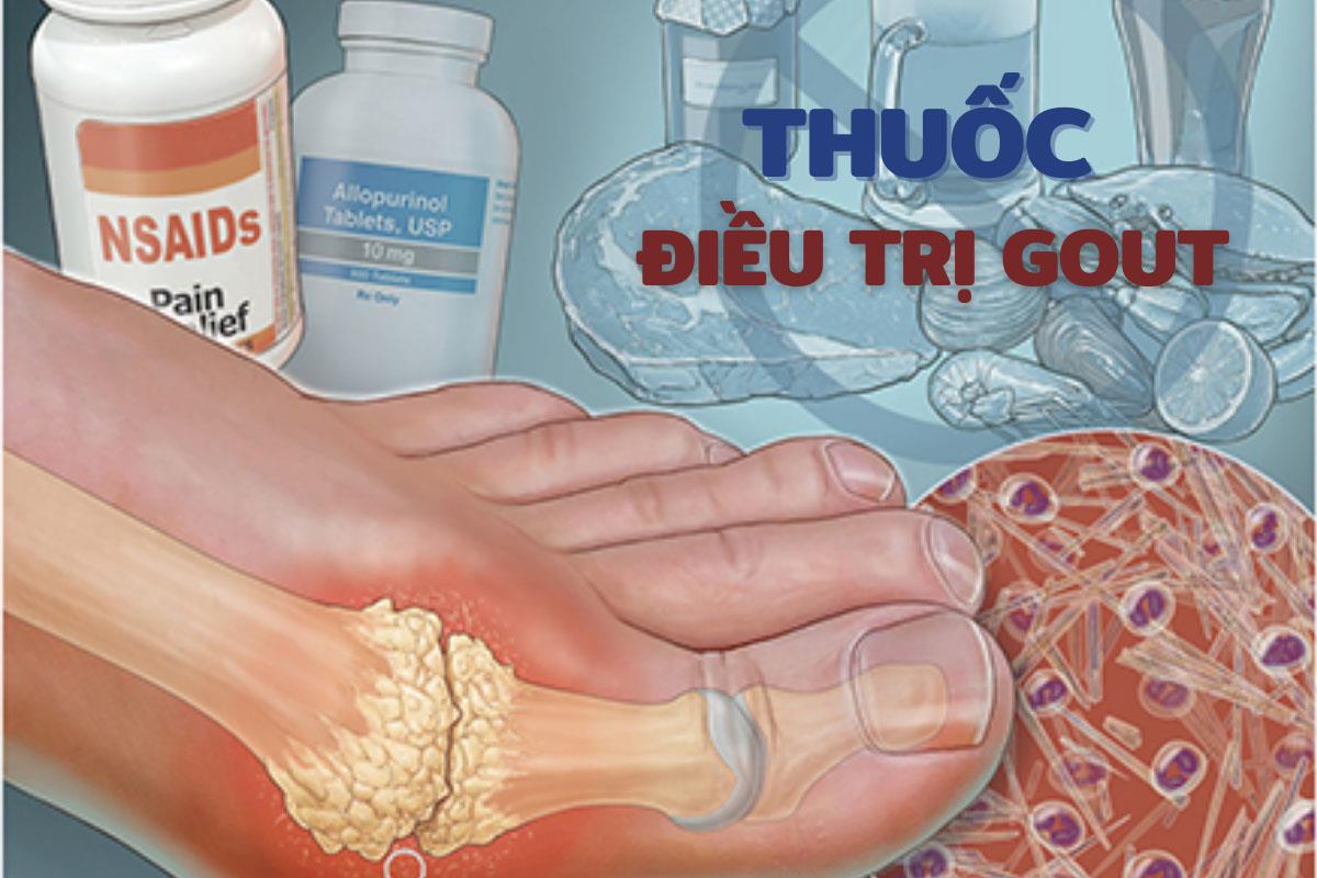 Thuốc điều trị gout cấp - gout mạn và phác đồ điều trị gout mới nhất ...