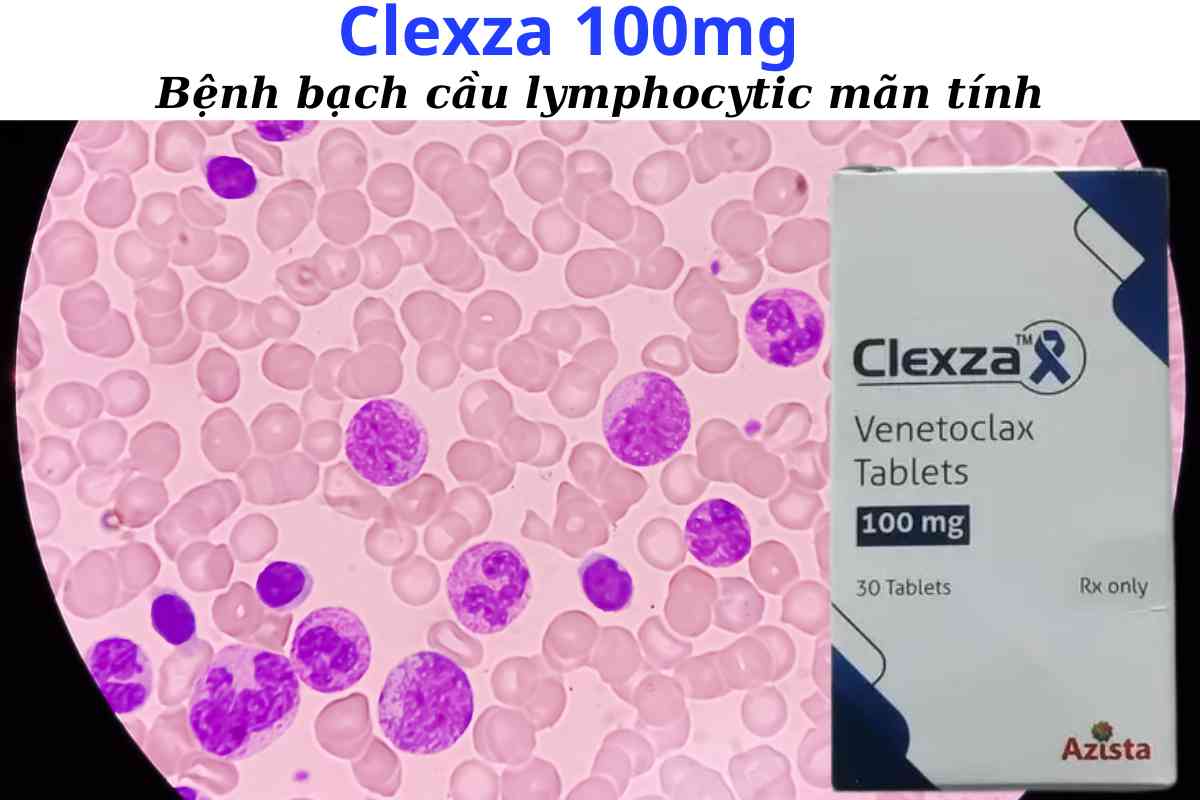 Thuốc Clexza 100mg điều trị bệnh bạch cầu lymphocytic mãn tính
