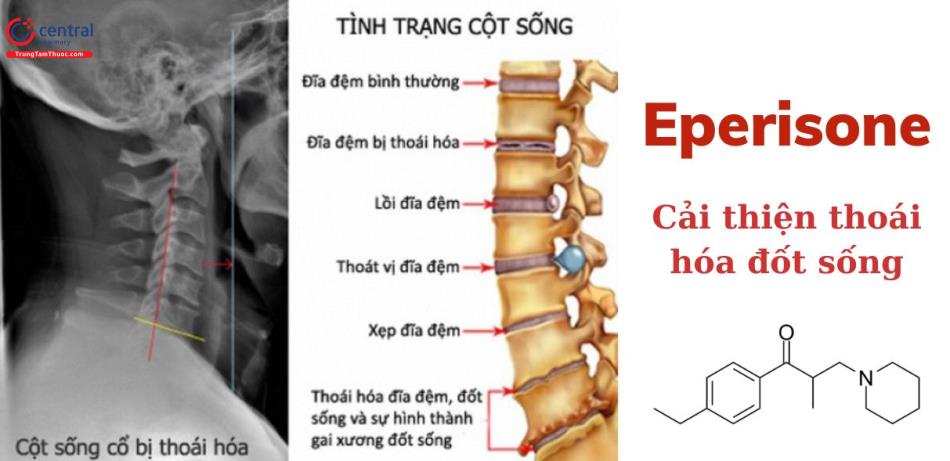 Eperisone làm giãn cơ vân và giãn mạch