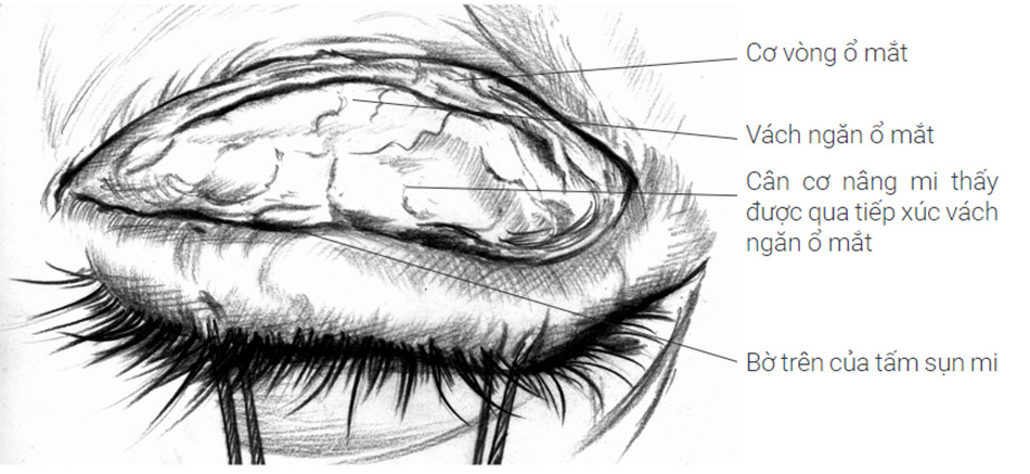 Đặc điểm giải phẫu mi mắt và những ứng dụng trong phẫu thuật mắt