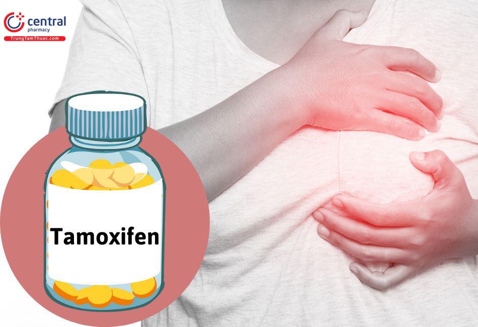 Tamoxifen thuốc điều trị ung thư vú hàng đầu hiện nay