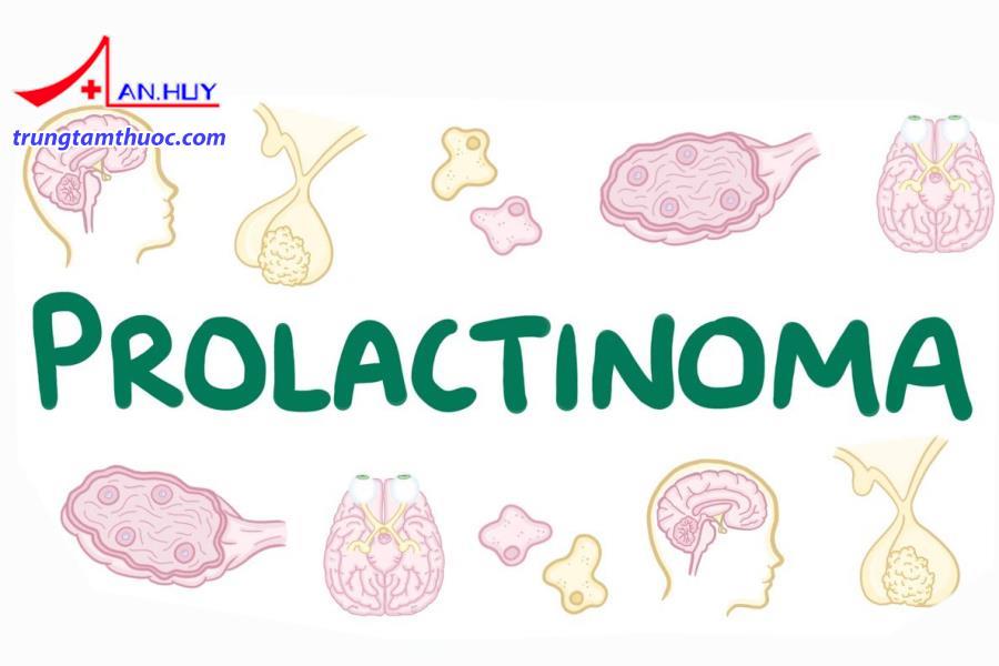 U TĂNG TIẾT PROLACTIN: NGUYÊN NHÂN, TRIỆU CHỨNG VÀ CÁCH ĐIỀU TRỊ
