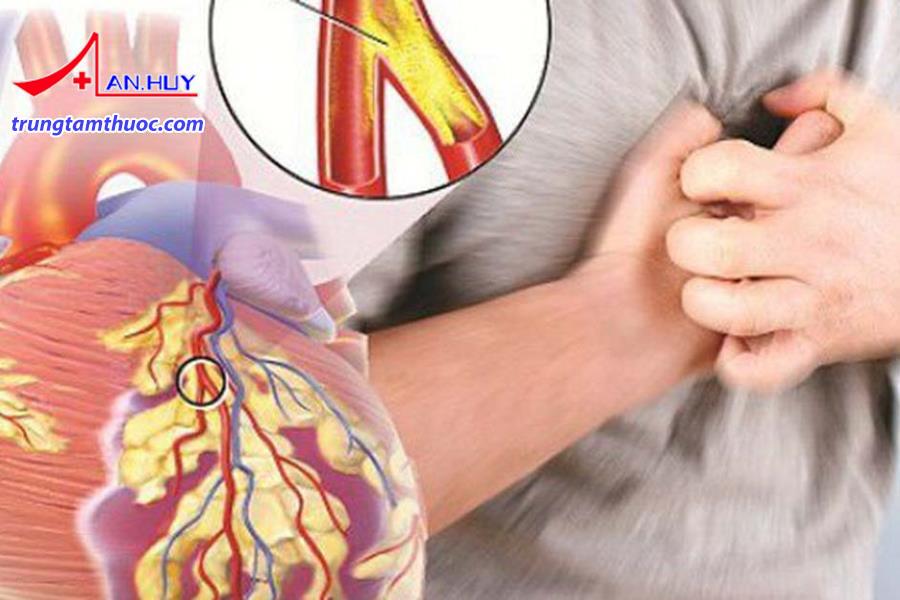 CHẨN ĐOÁN VÀ HƯỚNG DẪN ĐIỀU TRỊ BỆNH SUY TIM MẠN TÍNH